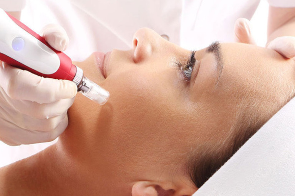 Micropen – Escarle Silva